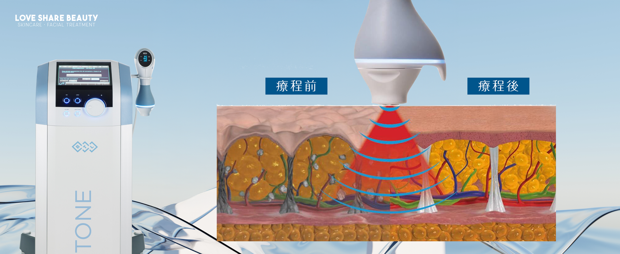 BTL Emtone®擊脂槍 – Love Share Beauty