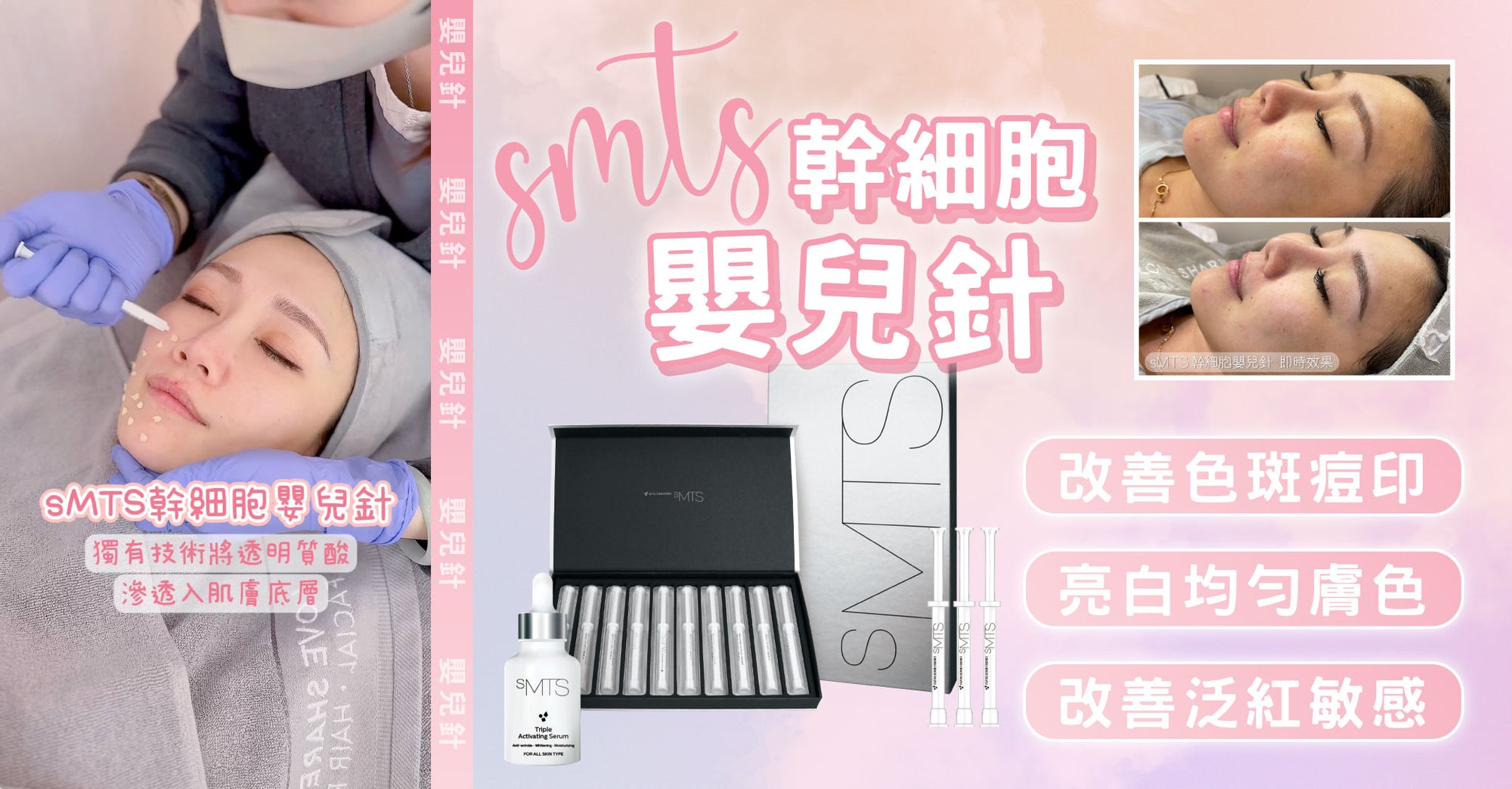 sMTS幹細胞嬰兒針療程 – Love Share Beauty